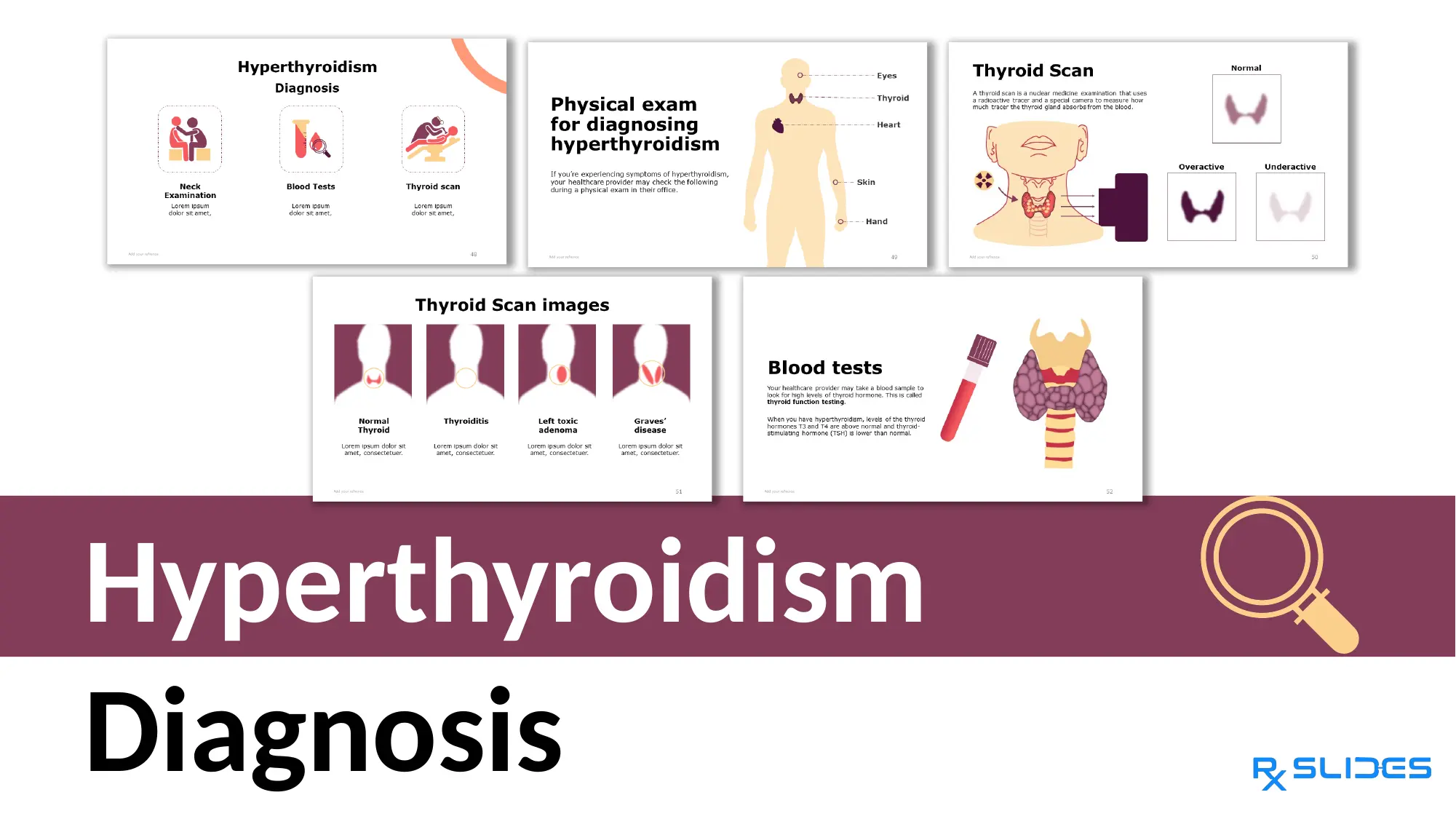 Download Hyperthyroidism PowerPoint Template|RxSlides